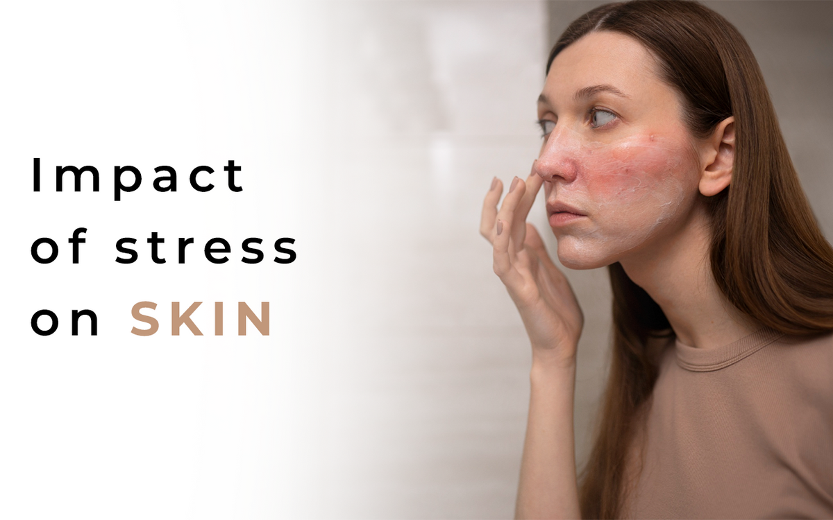 How Stress Affects Your Skin: Understanding the Connection ...